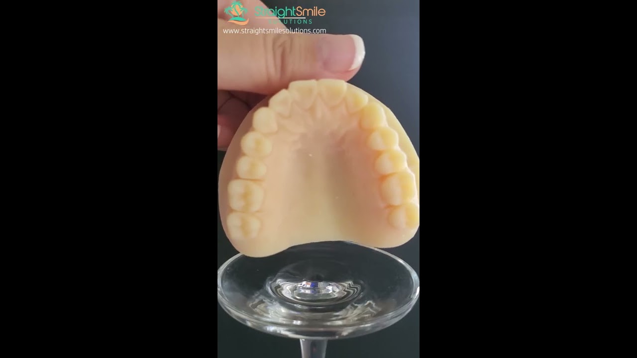 Bite Plates for Braces and Phase 1 Overbites and Deep Bites https://www ...