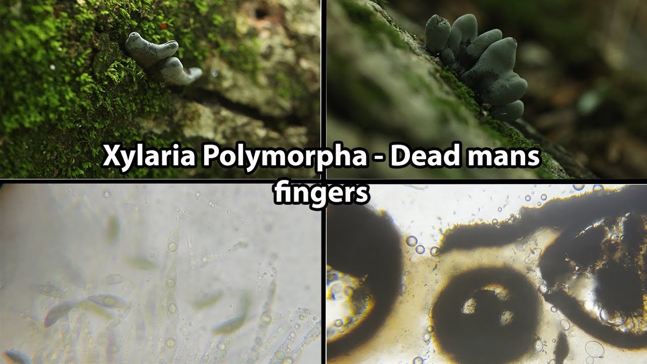 Xylaria Under Microscope