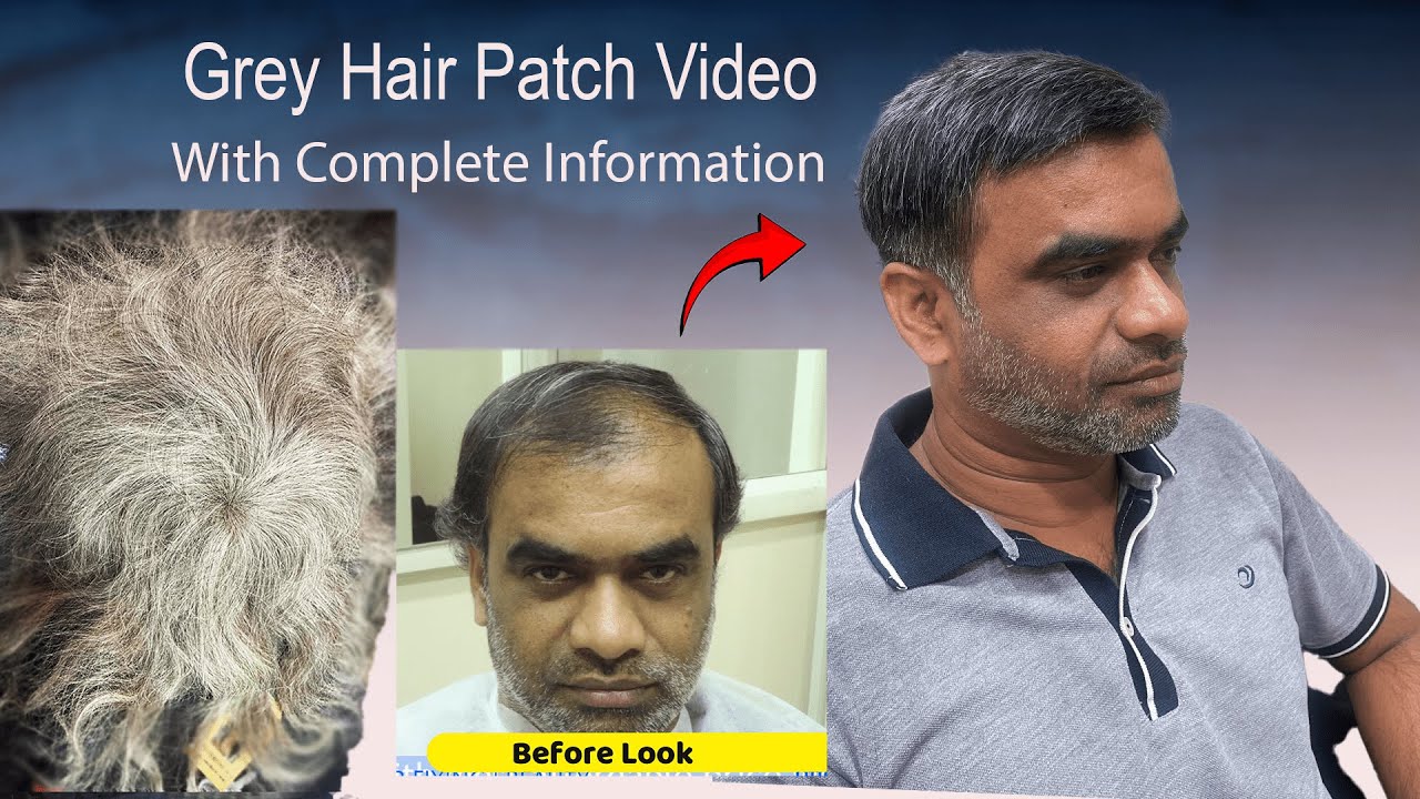 Hair patch video| Grey hair patch for aged cus | Hair Fixing in ...