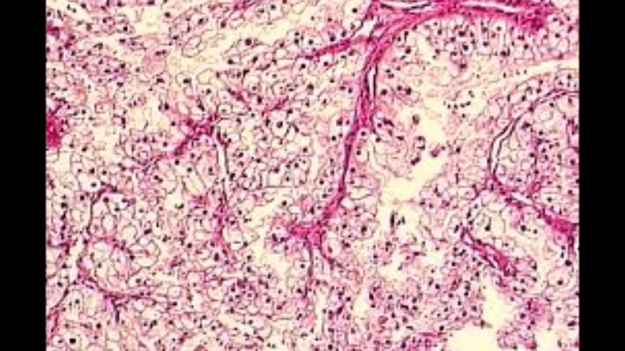 Tejido adiposo multilocular - YouTube