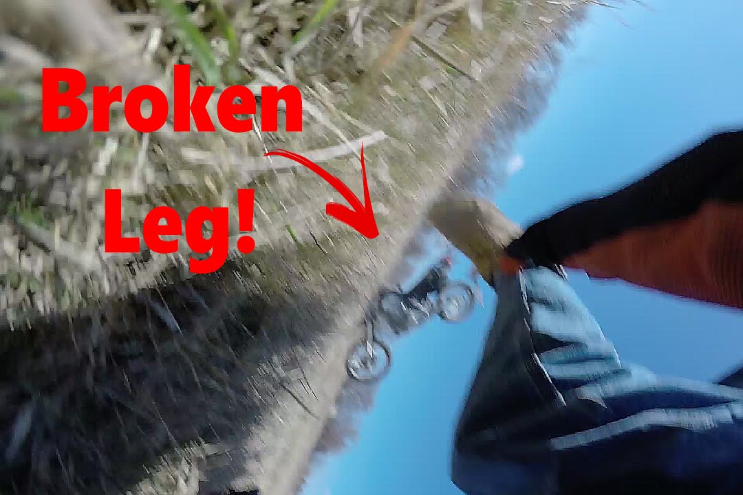 Motorcycle Crash Dual Sport Accident Broken Leg Injury Gopro - YouTube