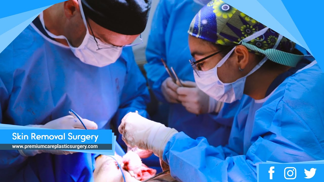 Skin Resection After Weight Loss: Chest Lift, Tummy Tuck, Posterior ...