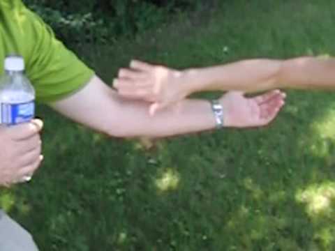 Arm Slap in Slow Motion at 420 FPS - YouTube