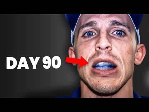 SleepObrace - Orthodontist's Honest Opinion - YouTube