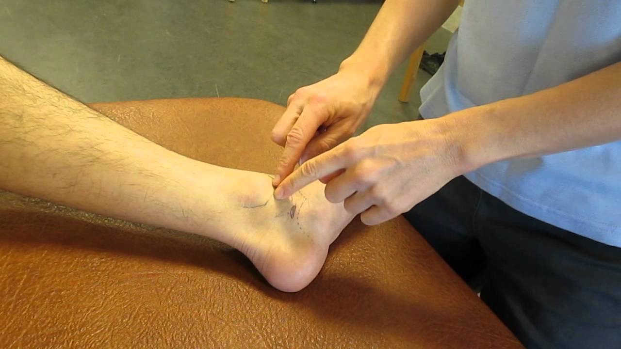 Sustentaculum Tali, Medial Malleolus (Tibia), Ankle, Palpation - YouTube