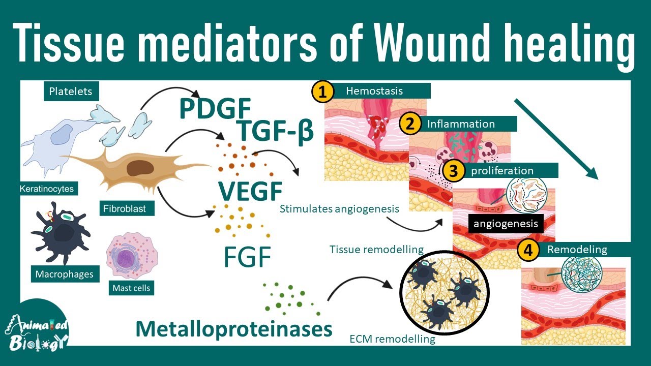 Tissue mediator of wound healing | Wound healing steps | USMLE step 1 ...