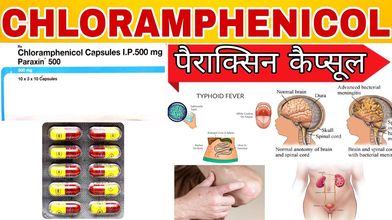 Chloramphenicol Capsule Uses,dose,Side-effects | Paraxin 500 capsules ...