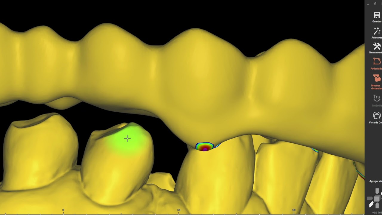 splint mod - YouTube