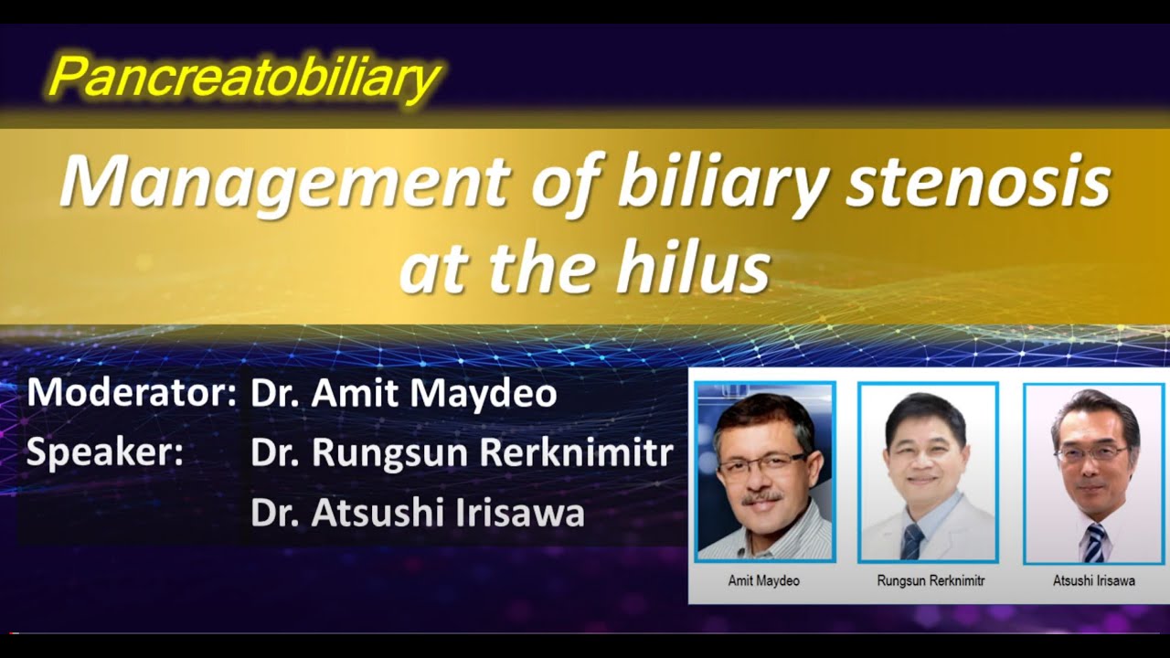 Management of biliary stenosis at the hilus - YouTube