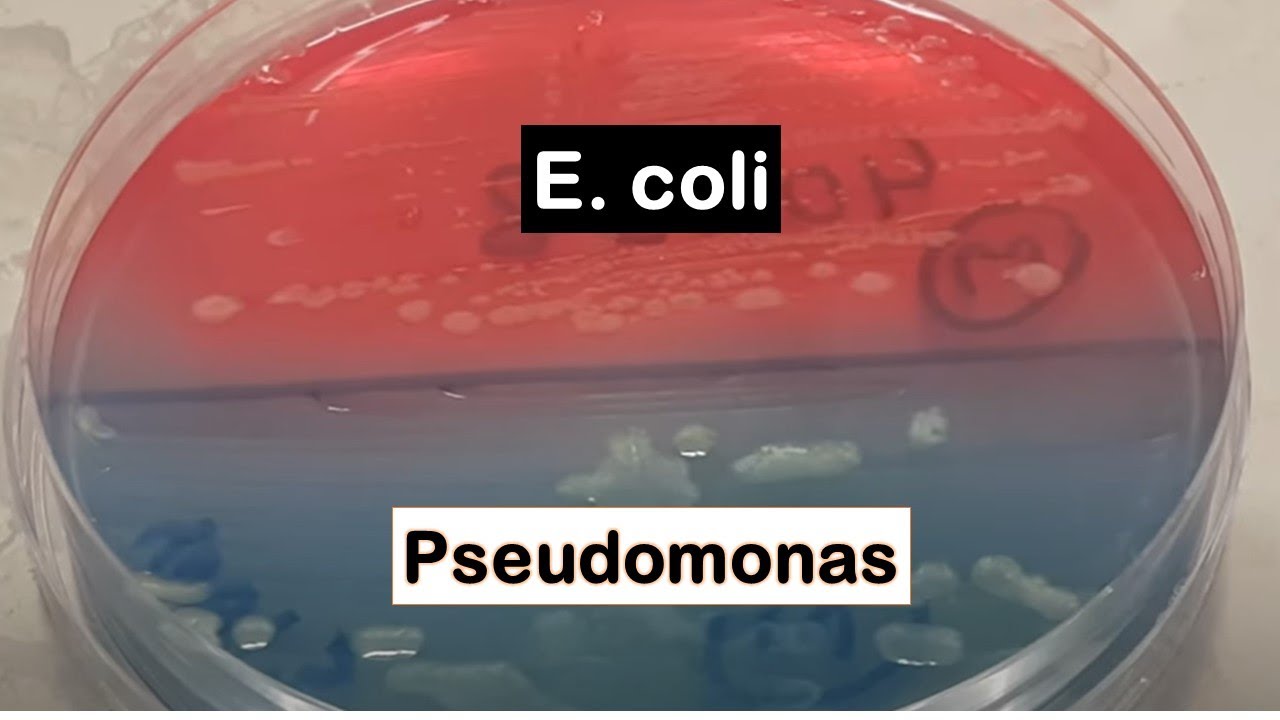 Pseudomonas aeruginosa and Escherichia coli colonies on CLED agar ...