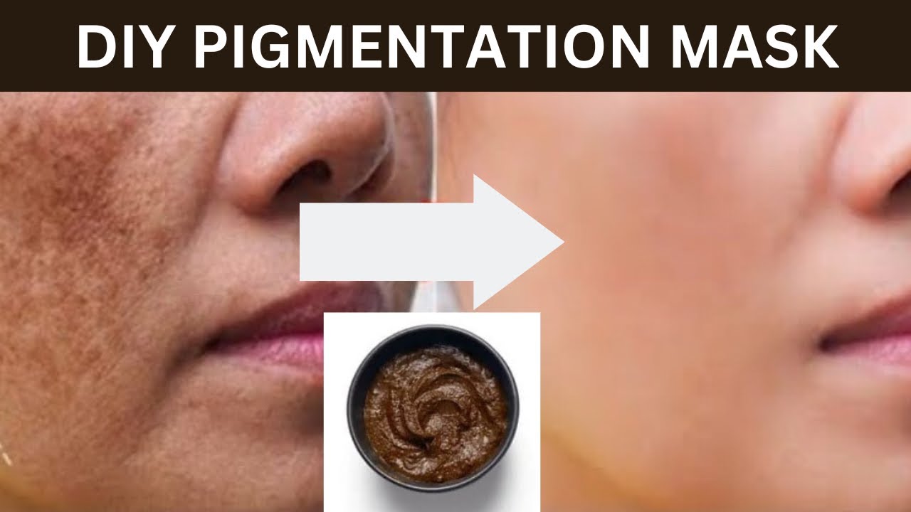 ONE FACE MASK for uneven skin tone problems | remove pigmentation ...