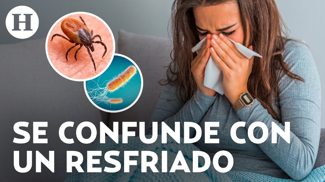 ¡Cuidado con la fiebre manchada! Síntomas de la Rickettsia, infección ...