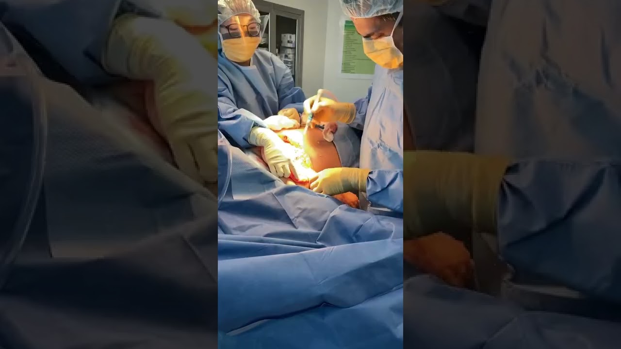 FTM Top Surgery From Start To Finish - YouTube