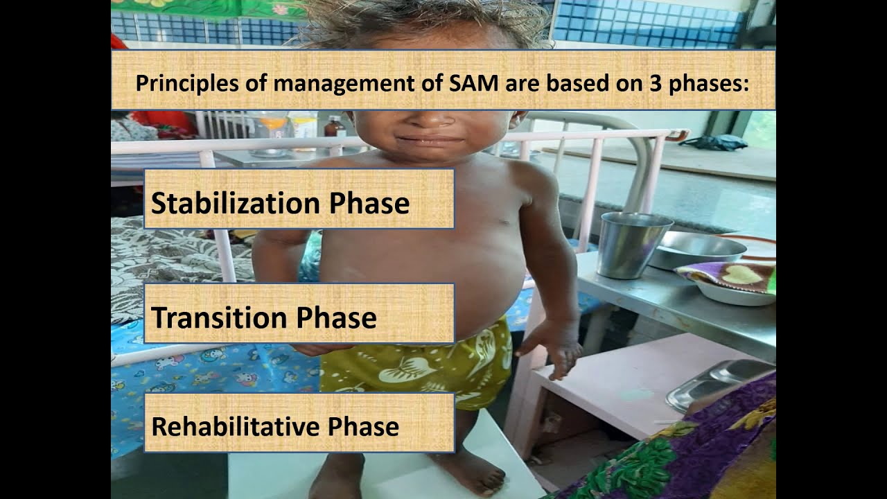 Severe Acute Malnutrition (Part 1/4) | Appetite test | Pediatrics - YouTube