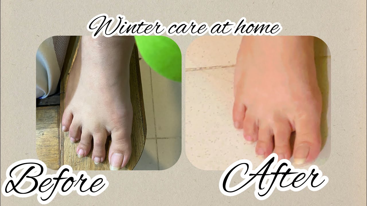 FEET WHITENING PEDICURE AT HOME FOR WINTER@beautystyleandme - YouTube