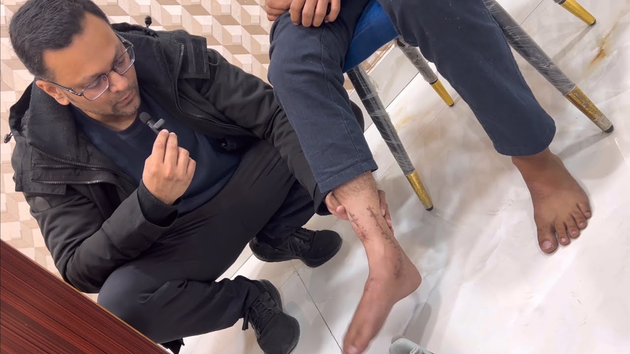 FOOT DROP Recovery video after surgery: Both Feet - YouTube