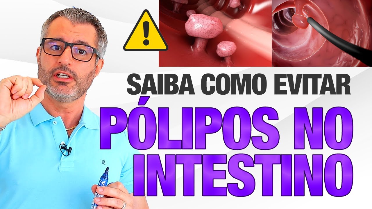 O que você precisa saber para evitar PÓLIPOS - YouTube