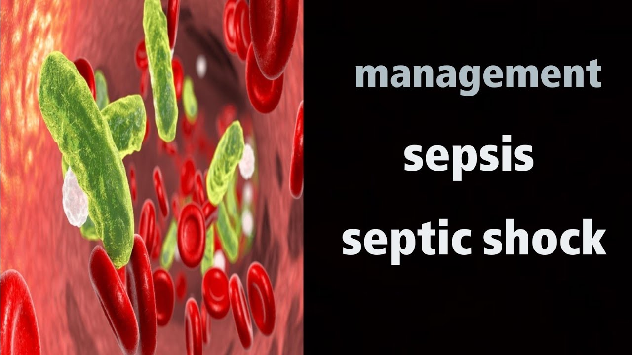 rapid review of management of sepsis and septic shock - YouTube