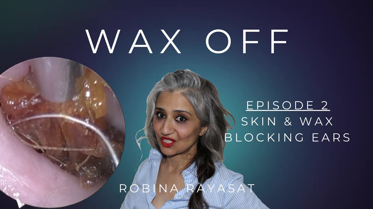 Skin & Earwax Blocking Ears | Wax Off - Episode 2 - YouTube