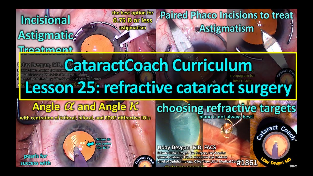 CataractCoach™ 1861: curriculum lesson 25: refractive cataract surgery ...