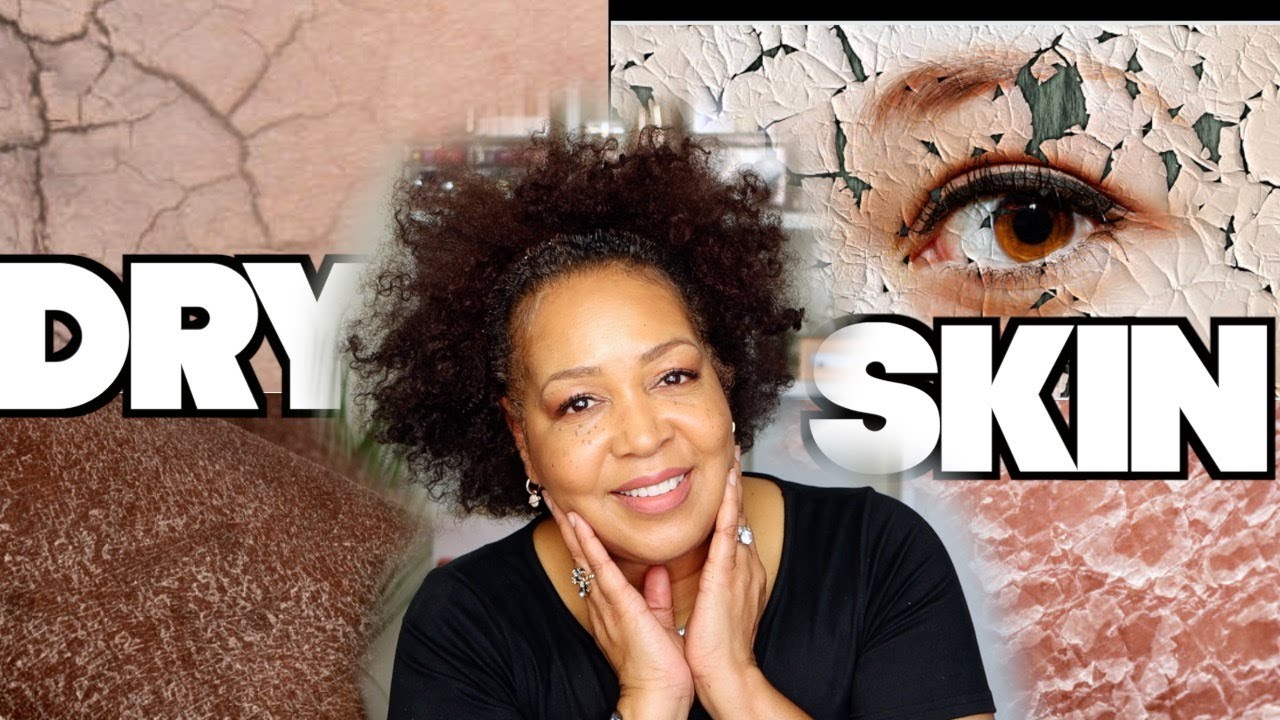 Why Your Skin Looks Dry & Flaky! Tips For Super Hydration All Day Long ...