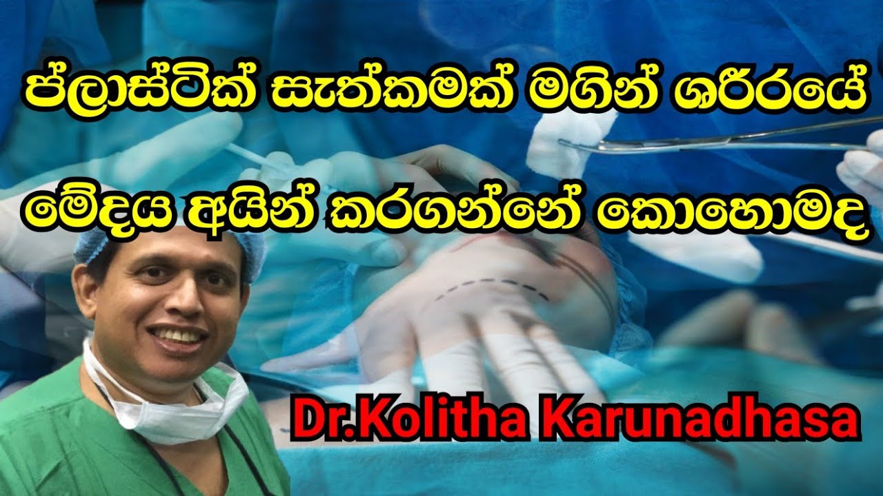 ප්ලාස්ටික් සැත්කමක් මගින් ශරීරයේ මේදය අඩු කර ගමු | Plastic surgery | Dr ...