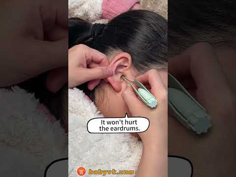 Worried About Q-Tip Dangers? Try the Baby Ear Cleaning Tool with Light! #babycare #earwaxremoval