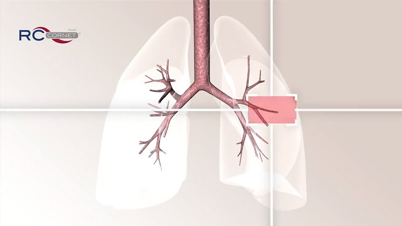 RC-Cornet® PLUS – Dispositivo de terapia respiratoria - YouTube