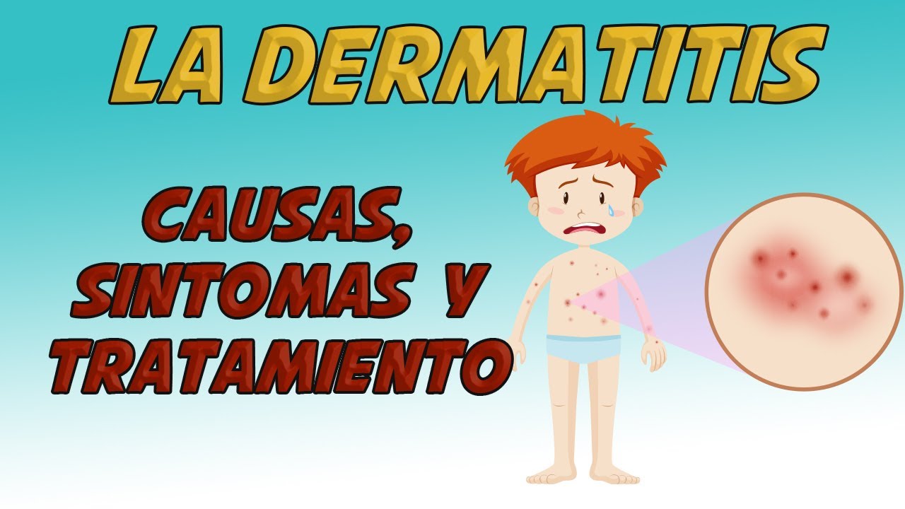 LA DERMATITIS, Causas, signos y síntomas, diagnóstico y tratamiento ...