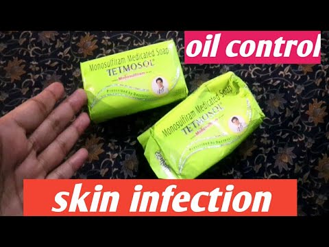 TETMOSOL medicated soap | honest review by be alert product reviews👍 ...