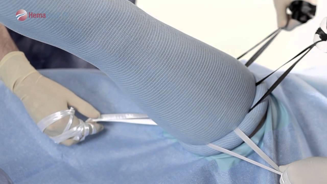 HemaClear Instructional Video for the Black & White Model (X-Large ...