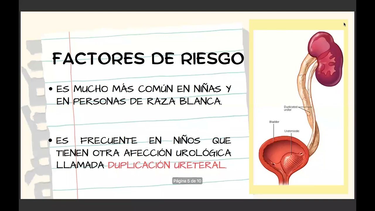 Ureterocele - YouTube