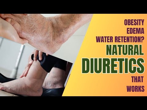 Natural DIURETICS That Works - Obesity, Fluid Retention, Edema Etc. # ...