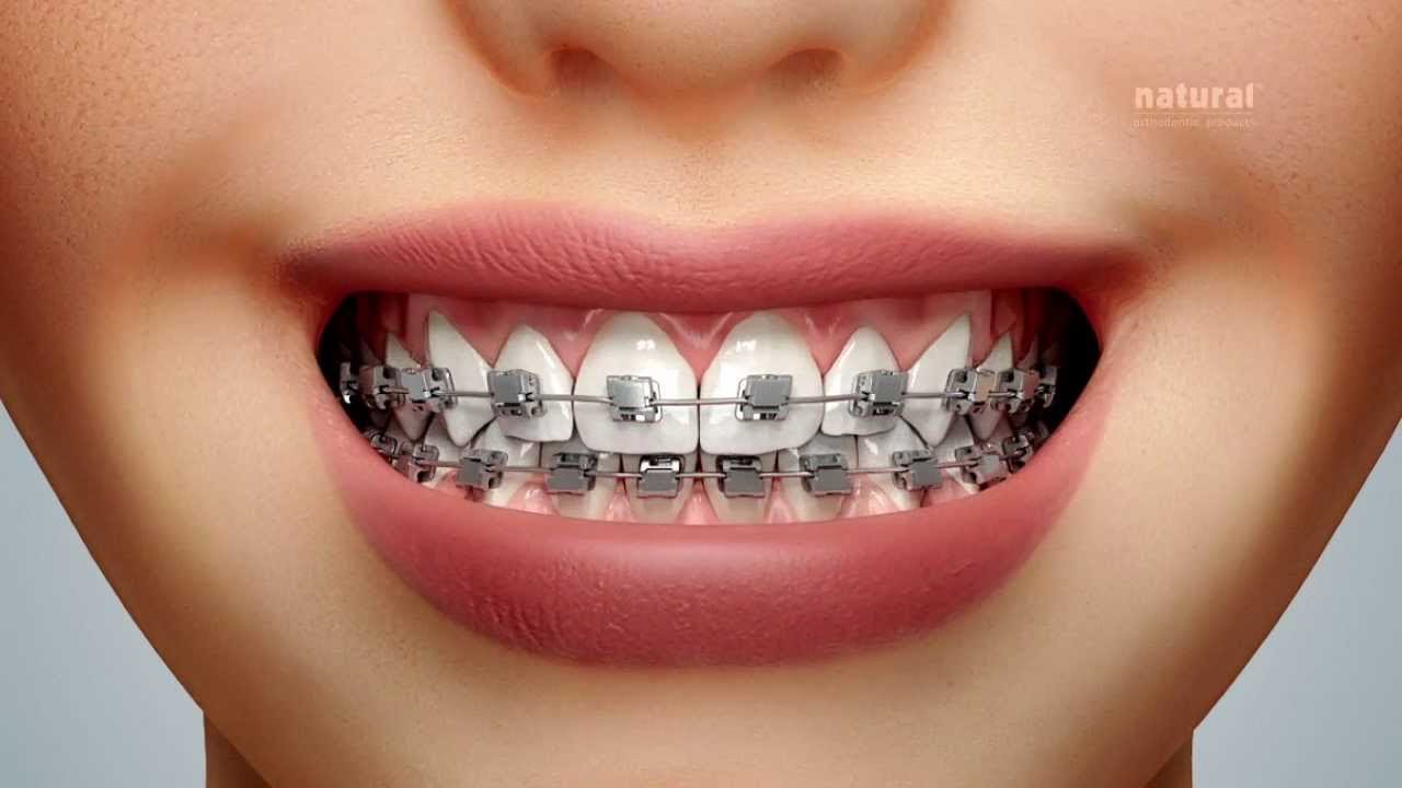 METAL MOUTH! - YouTube