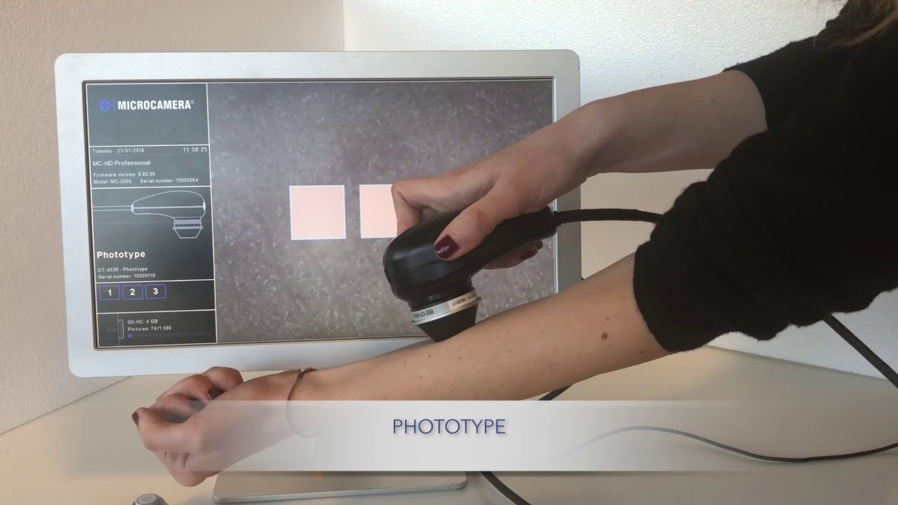 Short Tutorial MICROCAMERA® - Easy, right? - YouTube