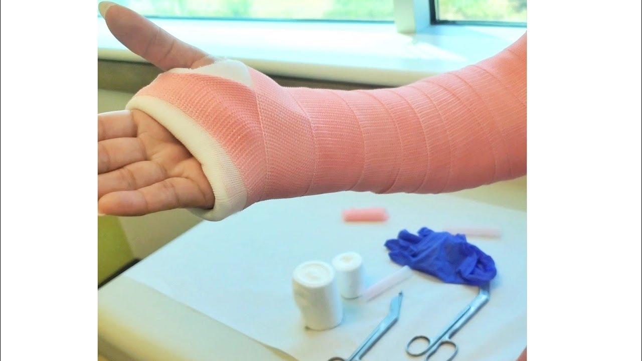 How to Make a Supinated/Pronated Long Arm Cast - YouTube