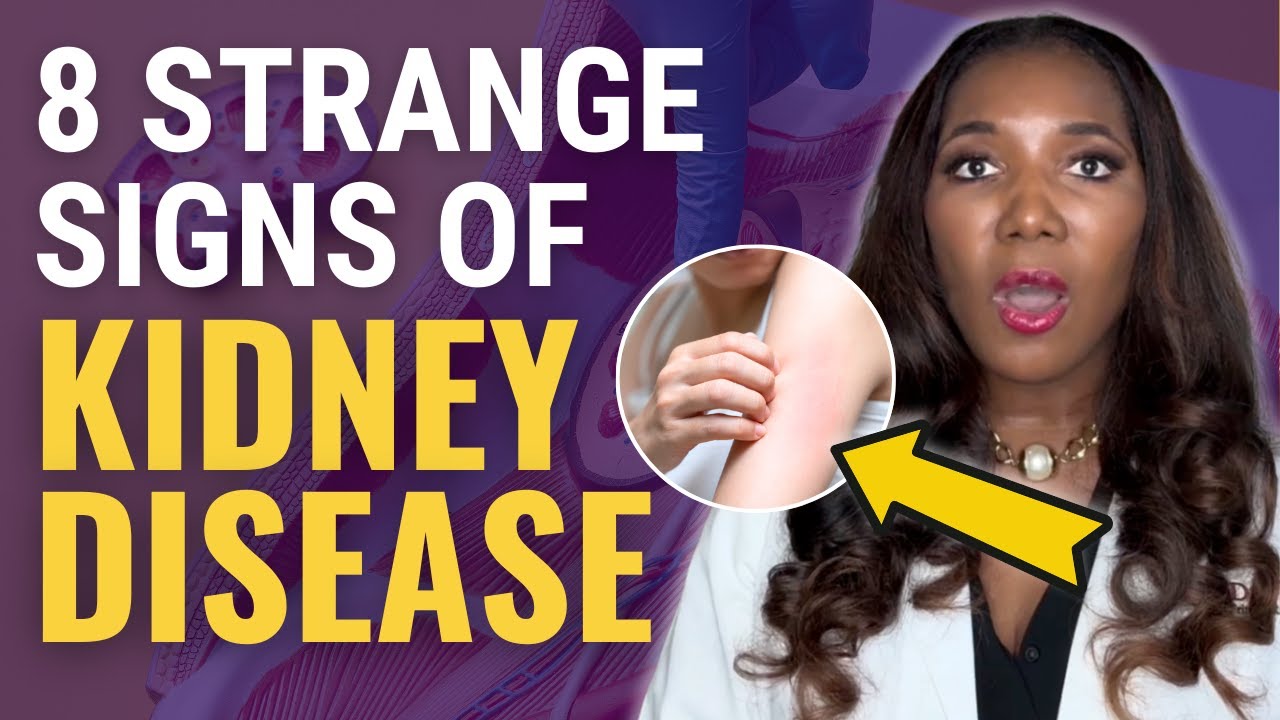 8 Strange Warning Signs of Kidney Disease That Seem Like Something Else