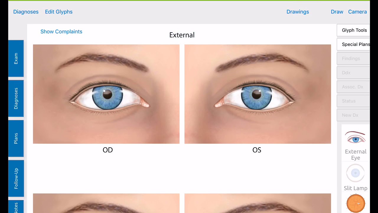 Charting a Comprehensive Exam in under 1 Minute with Eyefinity EHR ...