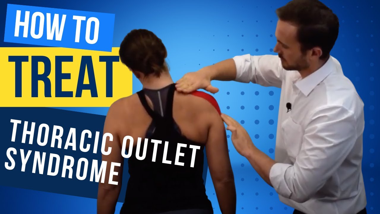 Thoracic Outlet Syndrome