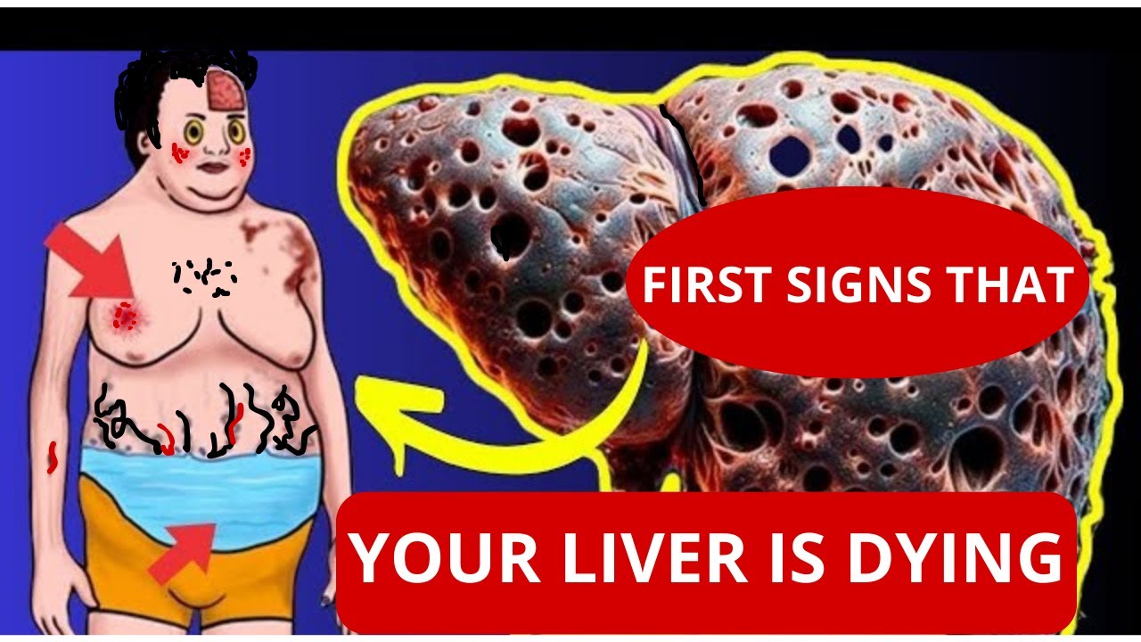 "12 Alarming Signs Your Liver Could Be Failing Don't Ignore These ...
