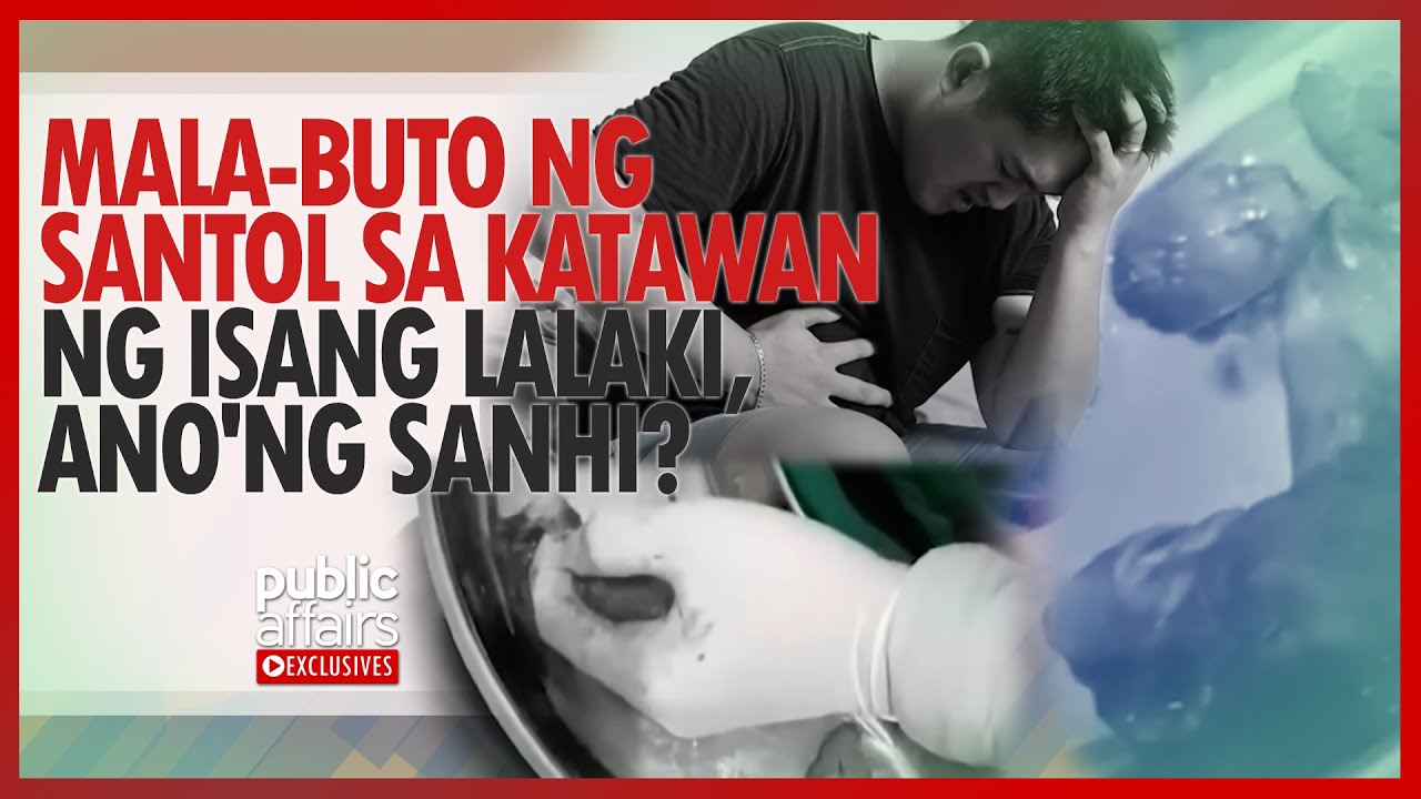 Mala-buto ng santol sa katawan ng isang lalaki, ano'ng sanhi? | Public ...