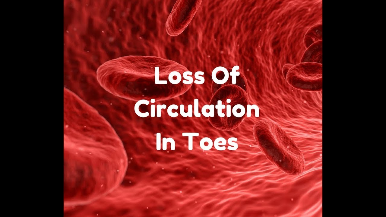 loss of circulation in toes - YouTube