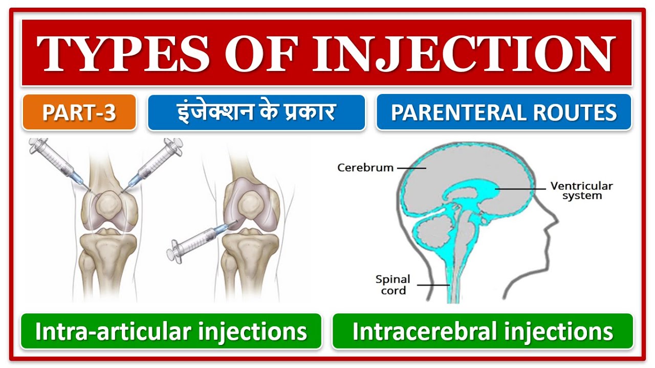 TYPES OF INJECTION | इंजेक्शन के प्रकार | PART-3 | INTRA-ARTICULAR ...