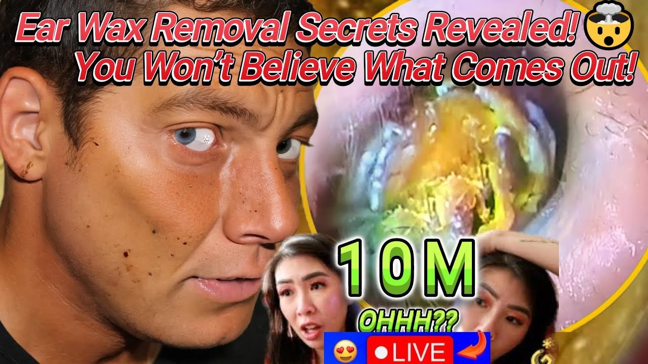 Ear Wax Removal Therapy 😌 | Relaxing, Gross, and Totally Addictive ...