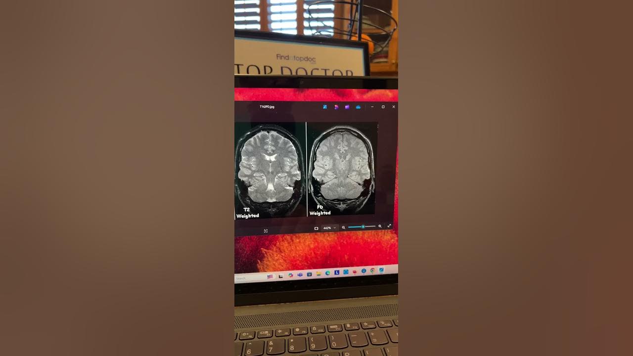 Demystifying Radiology 13 - MR images introduction - YouTube
