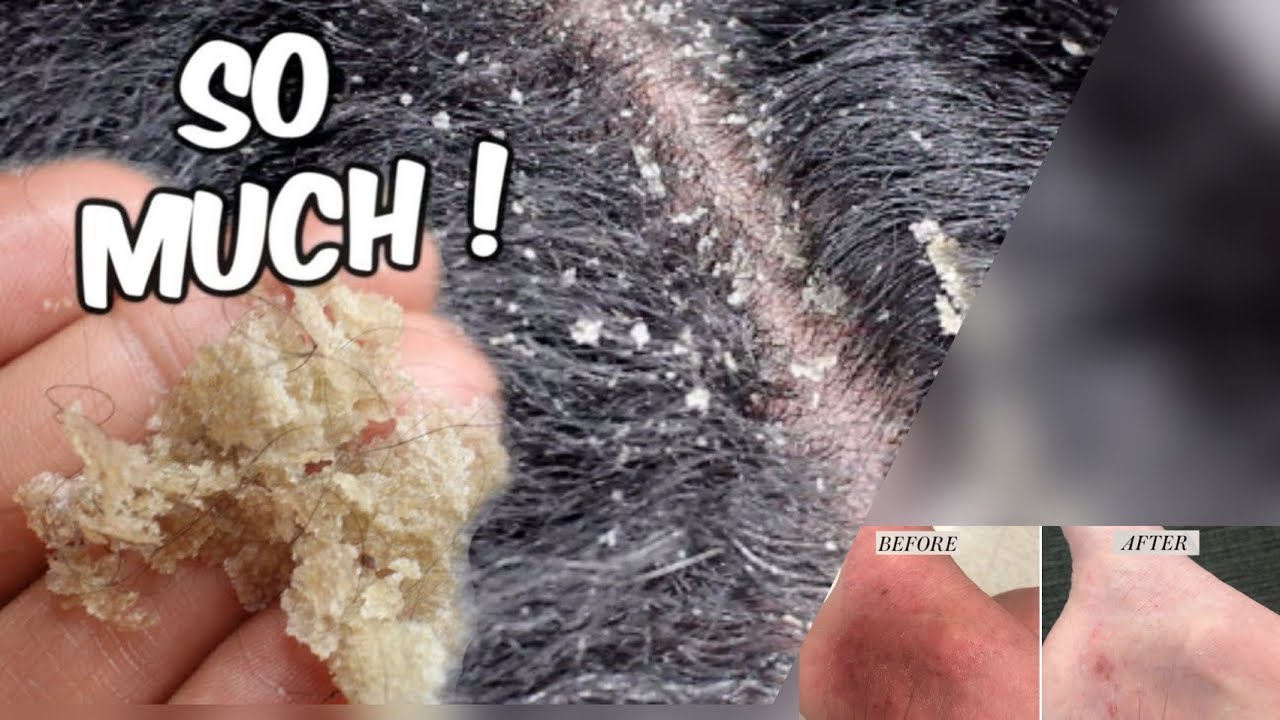 Danthapala ayurvedic oil review /ദന്തപാല എണ്ണ അടിമുടി അഴകിന് 💃_kpz ...