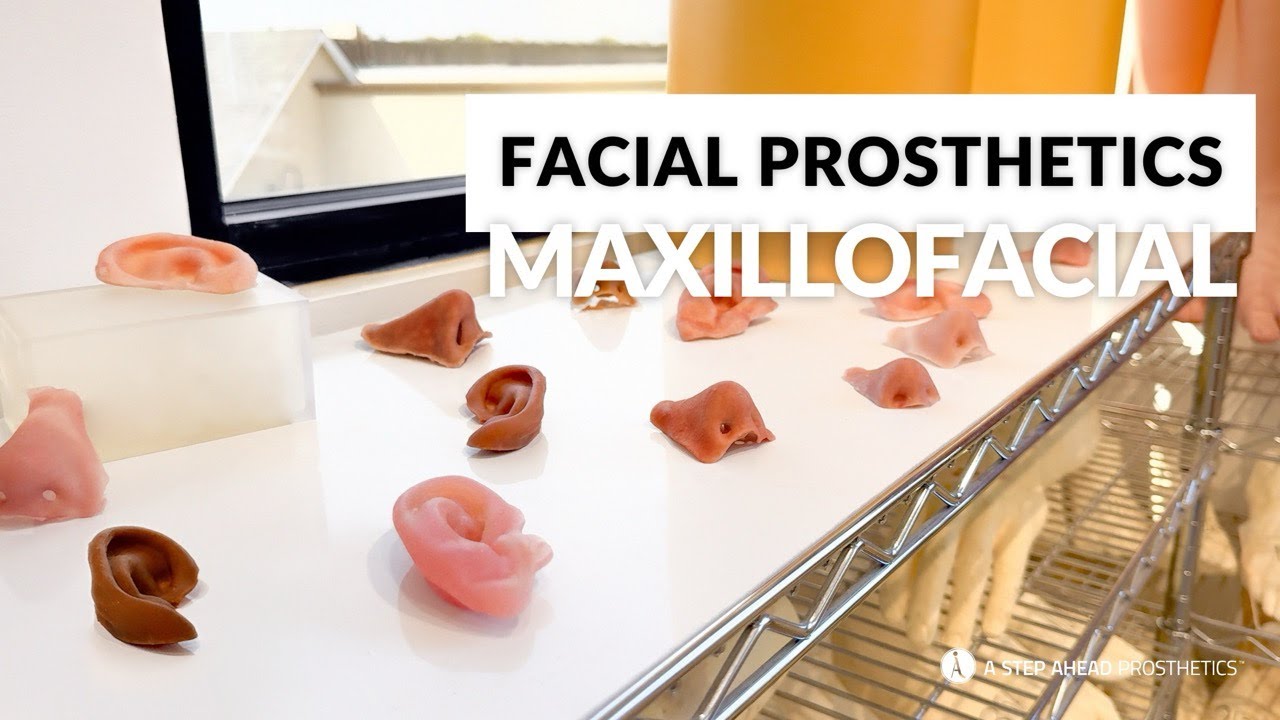 Custom Maxillofacial Prosthetics: Solutions for Facial Restoration and ...