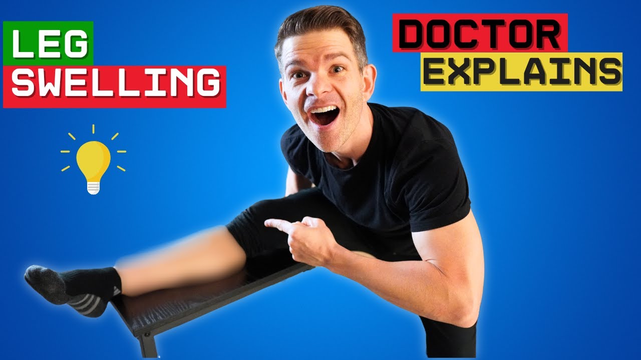 The 5 Causes of Leg Swelling & How to FIX Leg Swelling! Doctor Explains ...