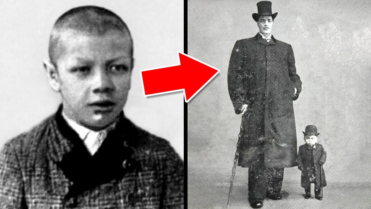Este Homem Foi Um Anão E Um Gigante Em Uma Vida Só - YouTube
