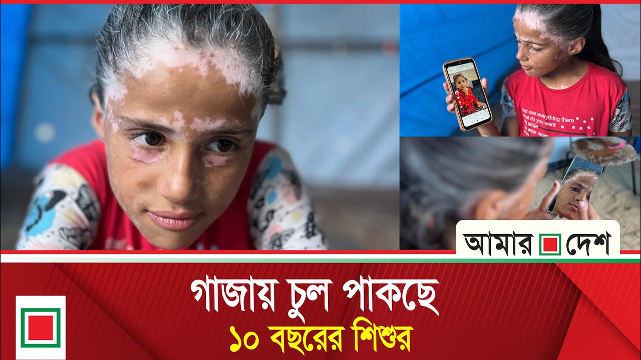 যু/ দ্ধে/ র বিভীষিকায় চুল পাকছে ১০ বছরের লানার | Amar Desh - YouTube